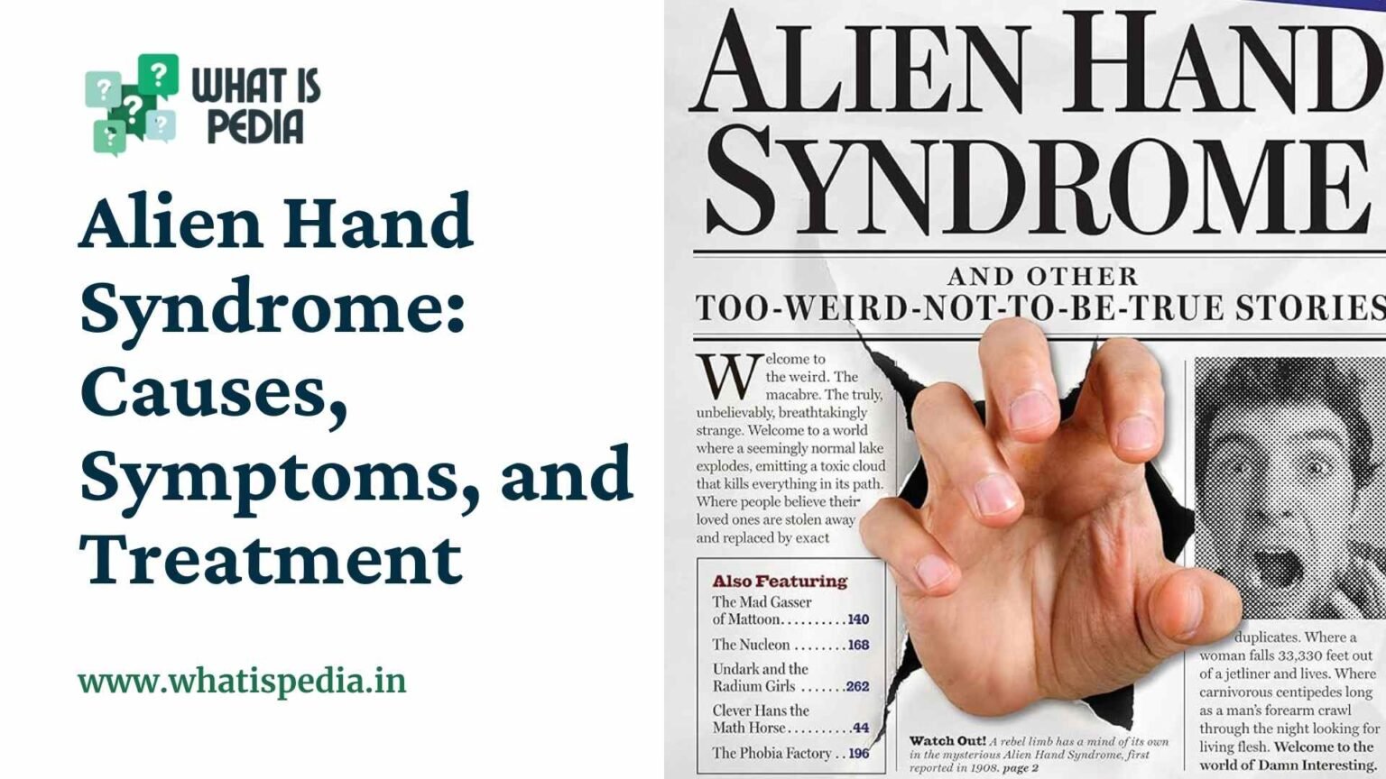 Alien Hand Syndrome In Details - Whatispedia