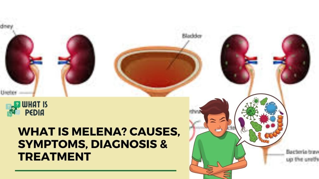 Understanding Melena: Causes, Symptoms & Treatment